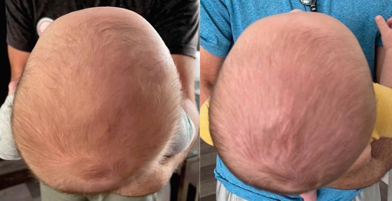 Perfect Noggin Infant Head Shaping Mattress