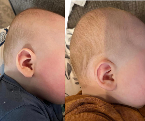 Perfect Noggin Infant Head Shaping Mattress