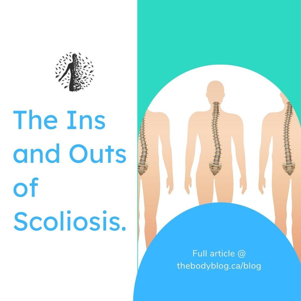 The Ins and Outs of Scoliosis