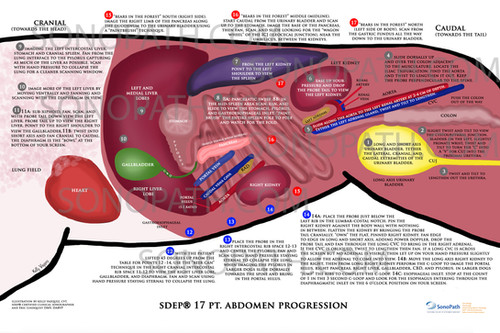 SDEP® 17 Pt. Abd. Progression Poster | SonoPath