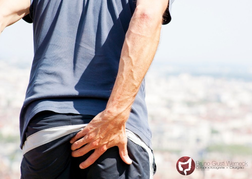 Abscesso perianal: quais são os sintomas e o que fazer?