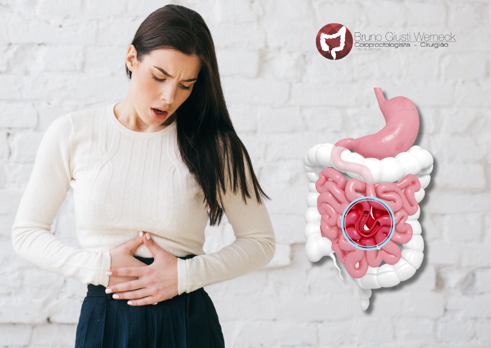 Obstrução intestinal: por que isso pode acontecer anos após a cirurgia ...