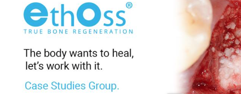 EthOss Bone Graft