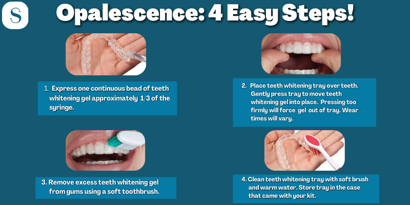 "Is Custom Opalescence Teeth Whitening Worth It Compared to Over-the ...