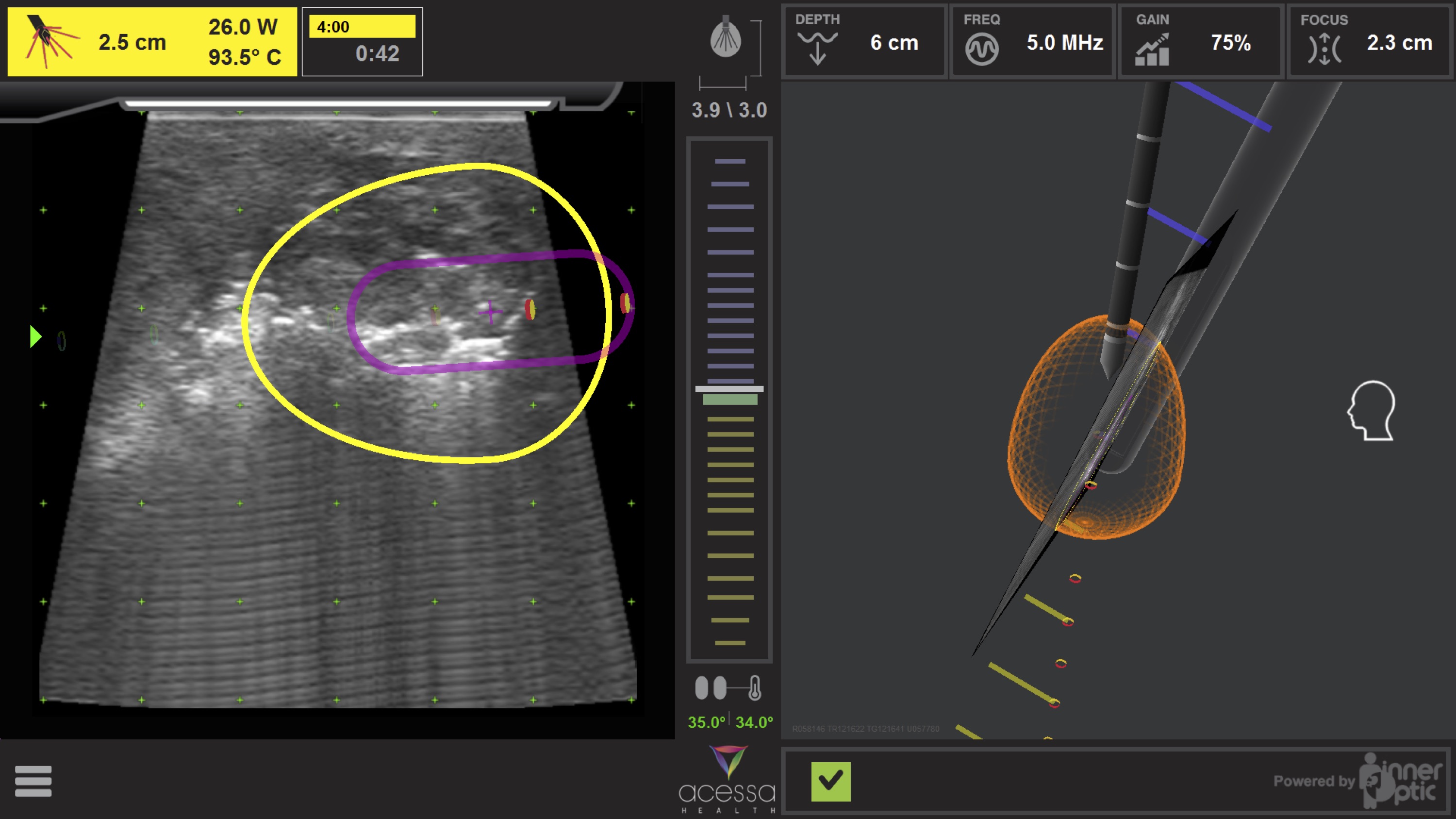 Home | InnerOptic Technology, Inc.