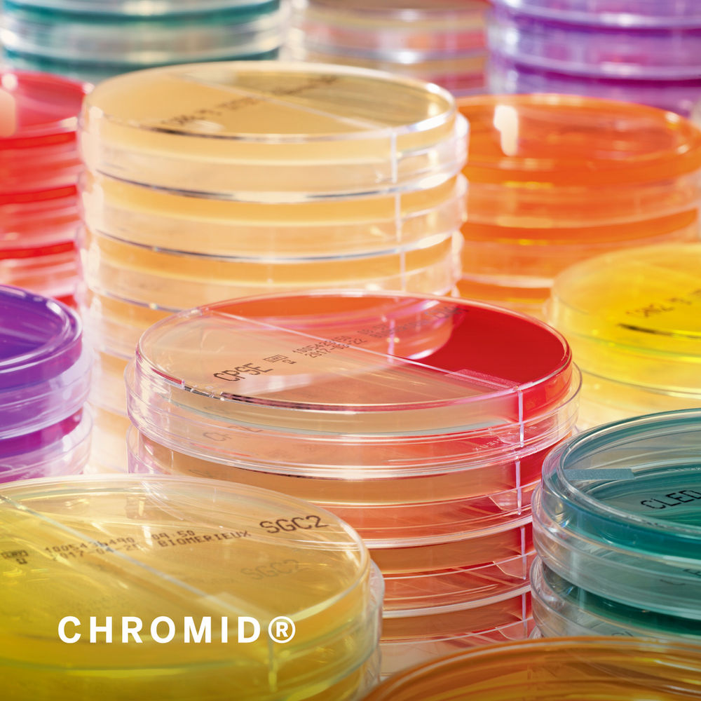 Con CHROMID®, identifique microorganismos asociados a las IAAS