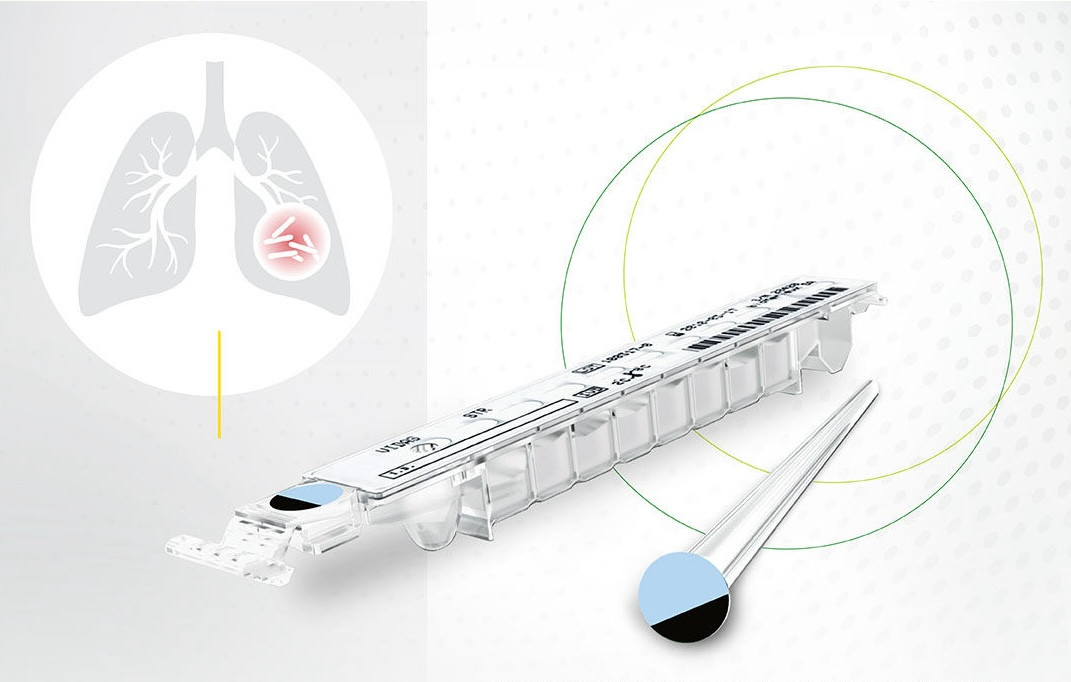 VIDAS® TB-IGRA: La prueba totalmente automatizada para detección de ...