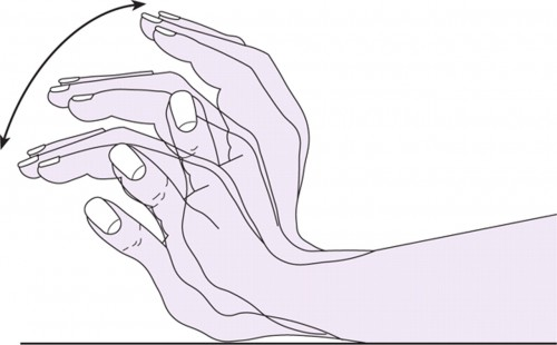 Asterixis,"Fancy term = danger sign"