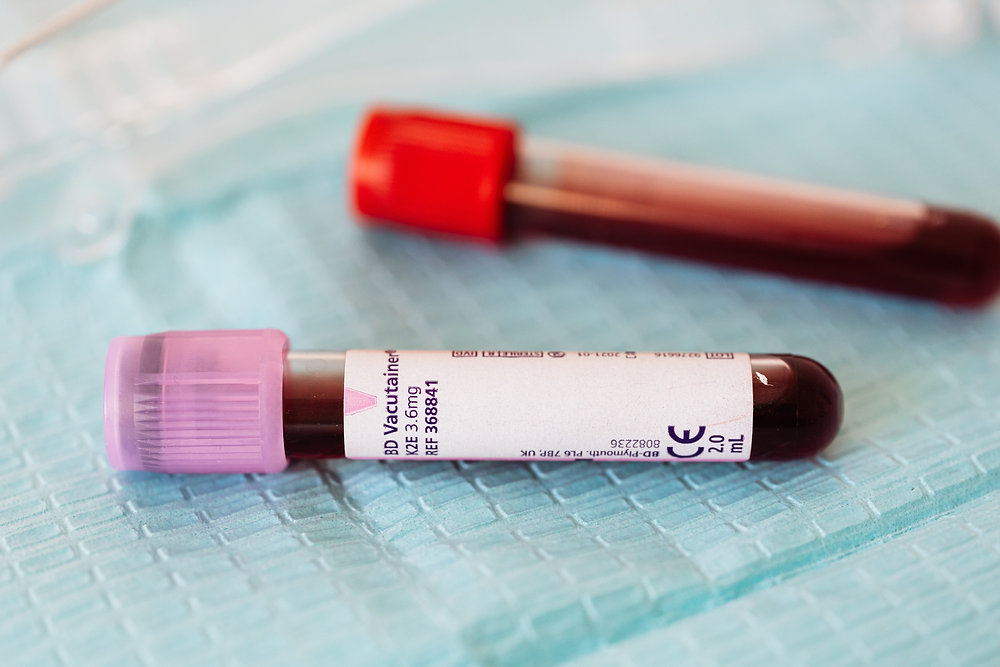 "Essential Steps for Proper Collection and Processing of a Blood Culture"