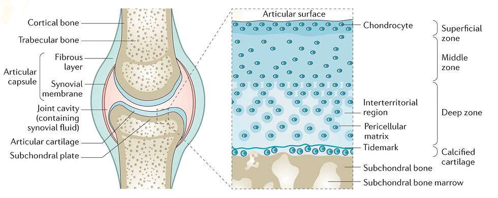 The Diversity of Arthritis Series: Osteoarthritis
