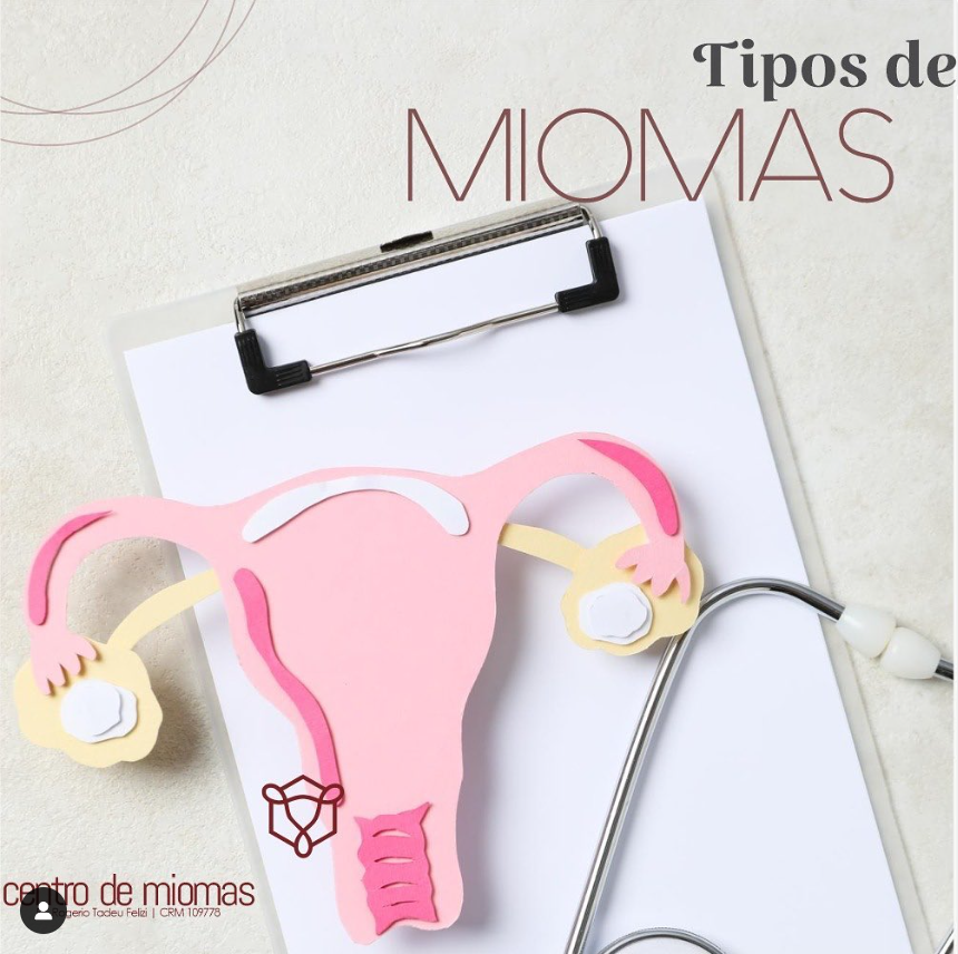 Tipos de miomas