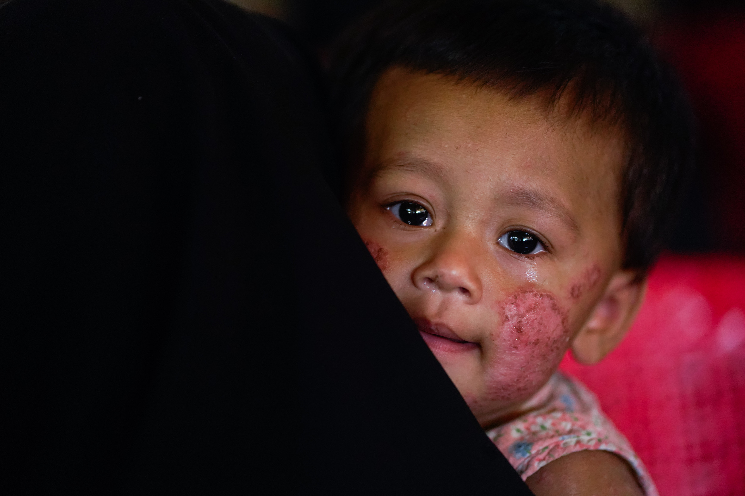 Rohingya children at risk: The human impact of cutting aid in the world ...