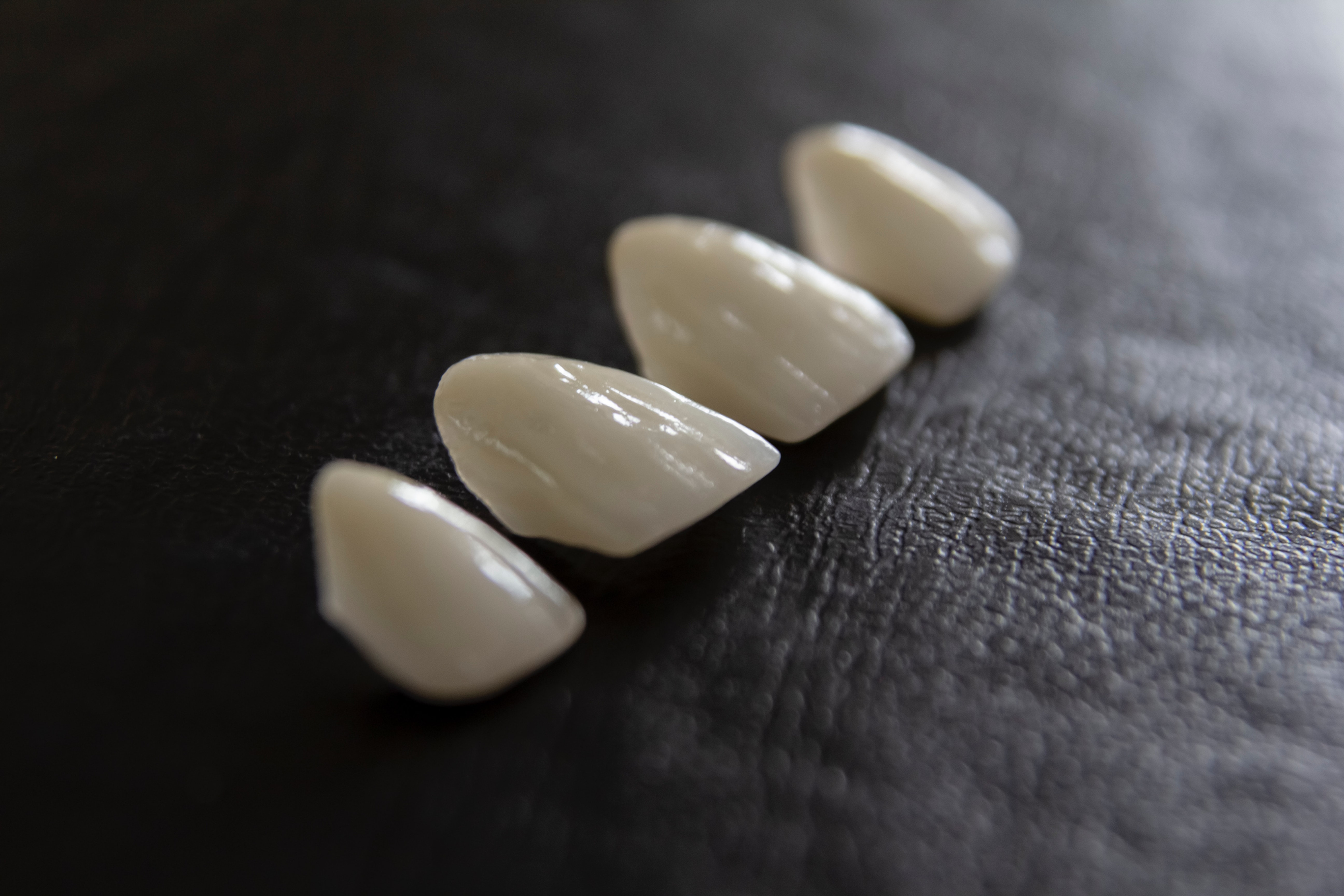Dental Crowns & Bridges
